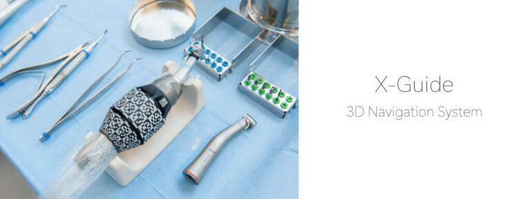 X-Guideを用いたインプラント手術の症例
